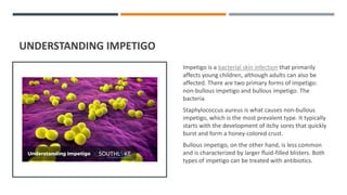 Impetigo Infection - Prevention Tips & Treatment Options.pdf