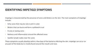 Impetigo Infection - Prevention Tips & Treatment Options.pdf