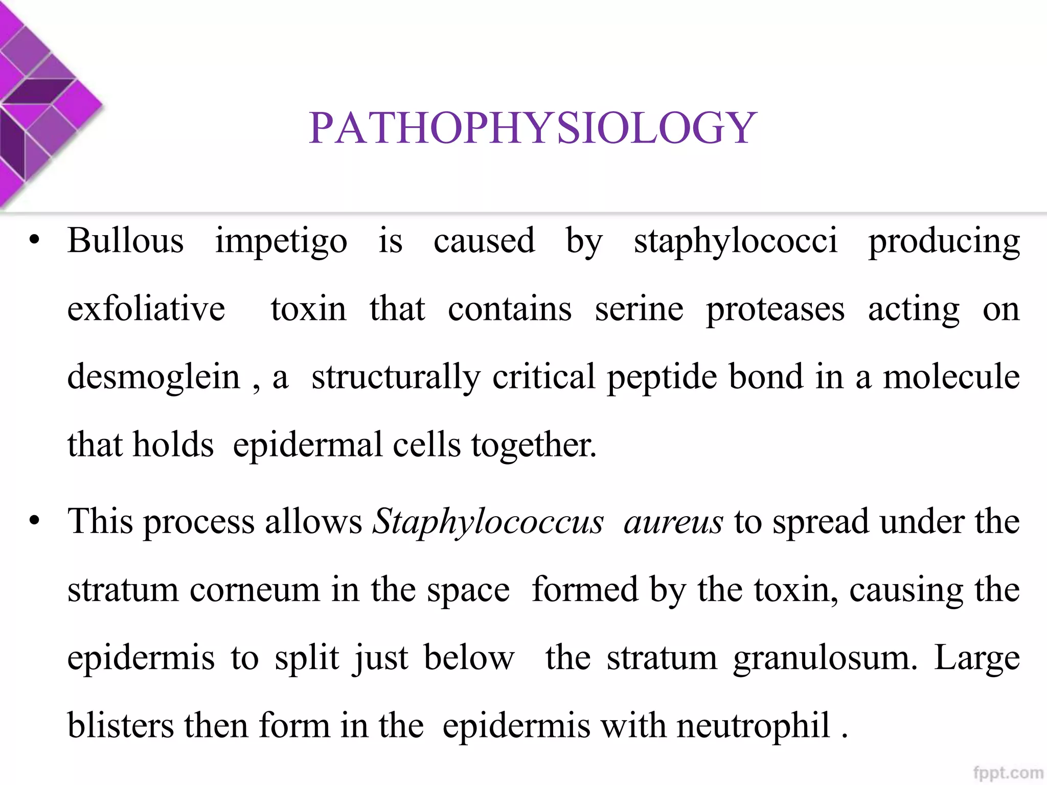 Impetigo | PPTX