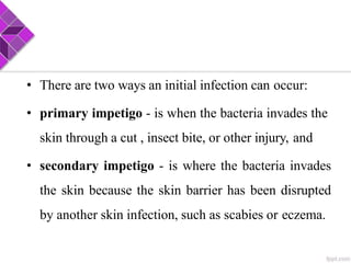 Impetigo | PPTX