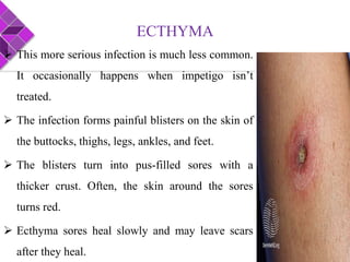 Ecthyma Impetigo