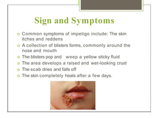 How to treat Empitigo Impetigo childcare caregiving module | PPTX