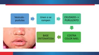 IMPETIGO Y ERISIPELA PEDIATRIA | PPTX