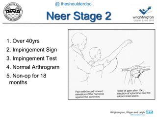 Impingement modern approach 2016 | PPT