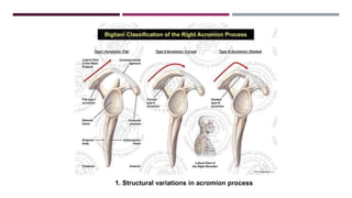 Impingement syndrome | PPTX