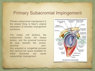 Impingement syndrome | PPTX
