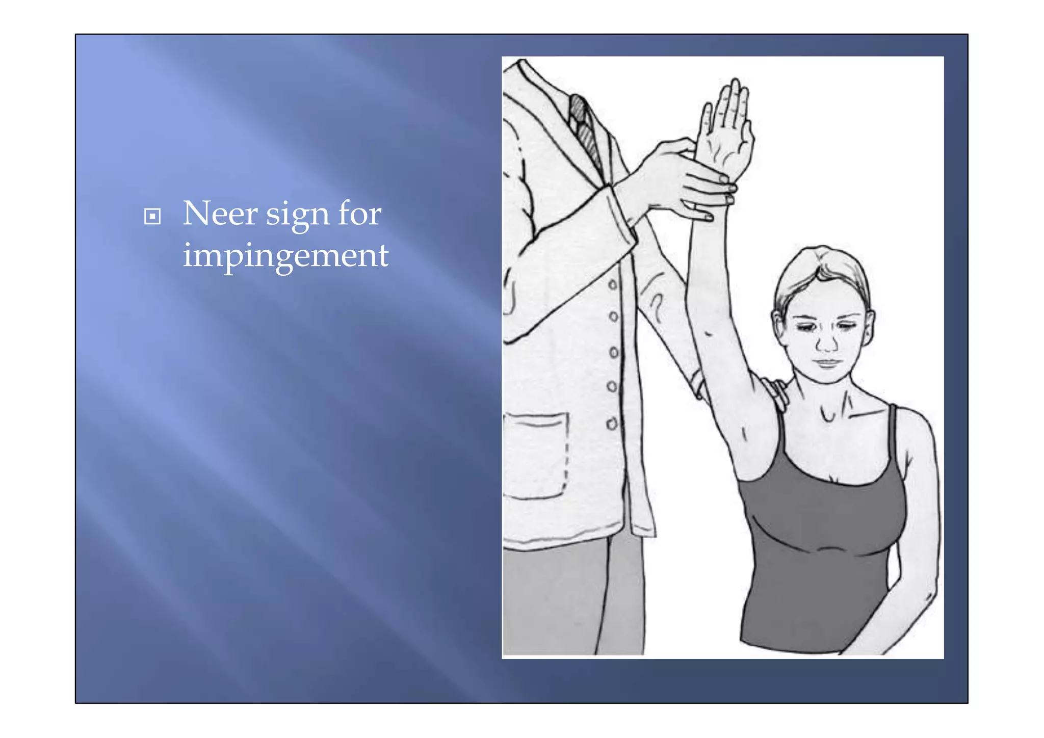 IMPINGMENT SYNDROME & ROTATOR CUFF TEAR.pptx