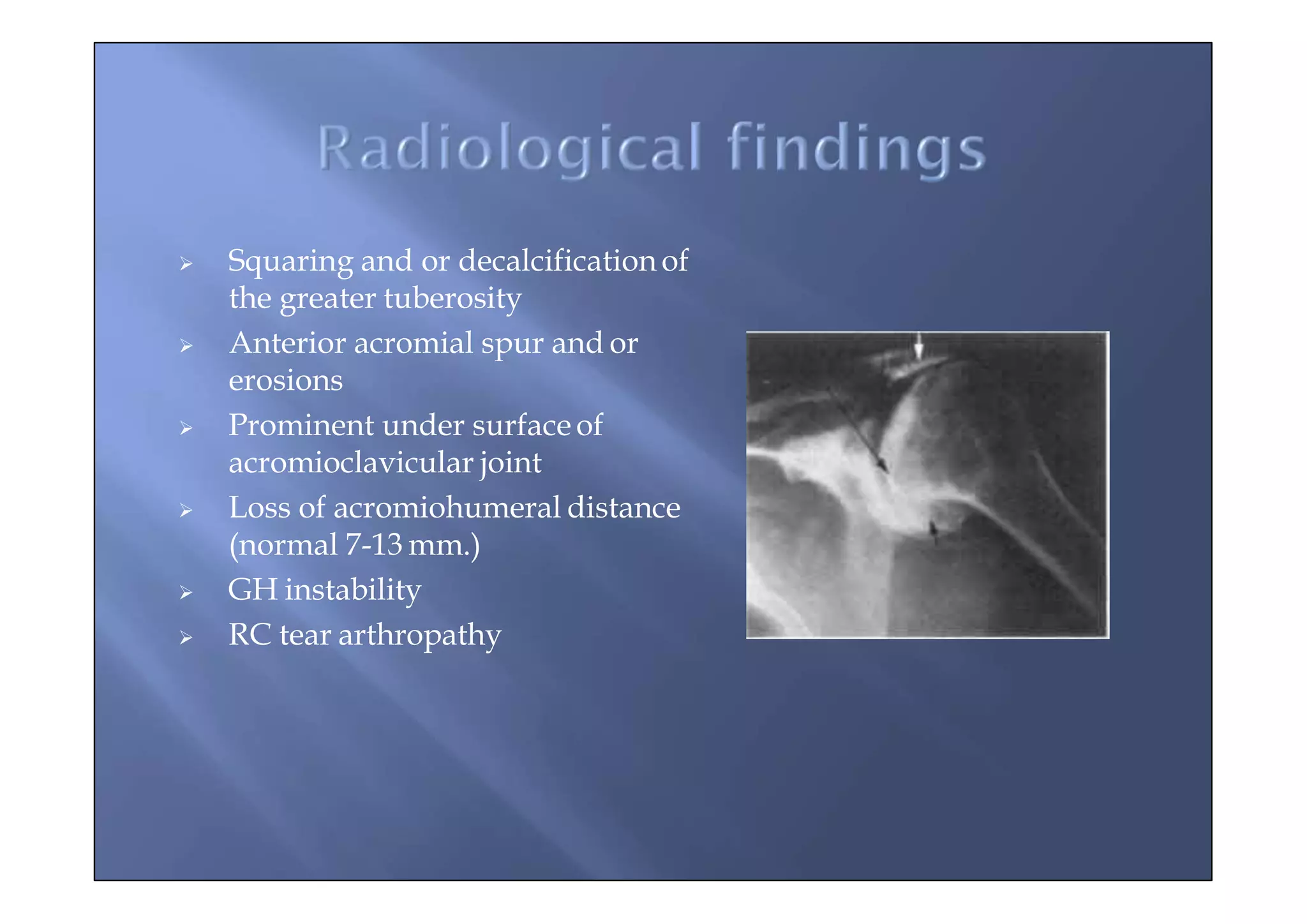 IMPINGMENT SYNDROME & ROTATOR CUFF TEAR.pptx