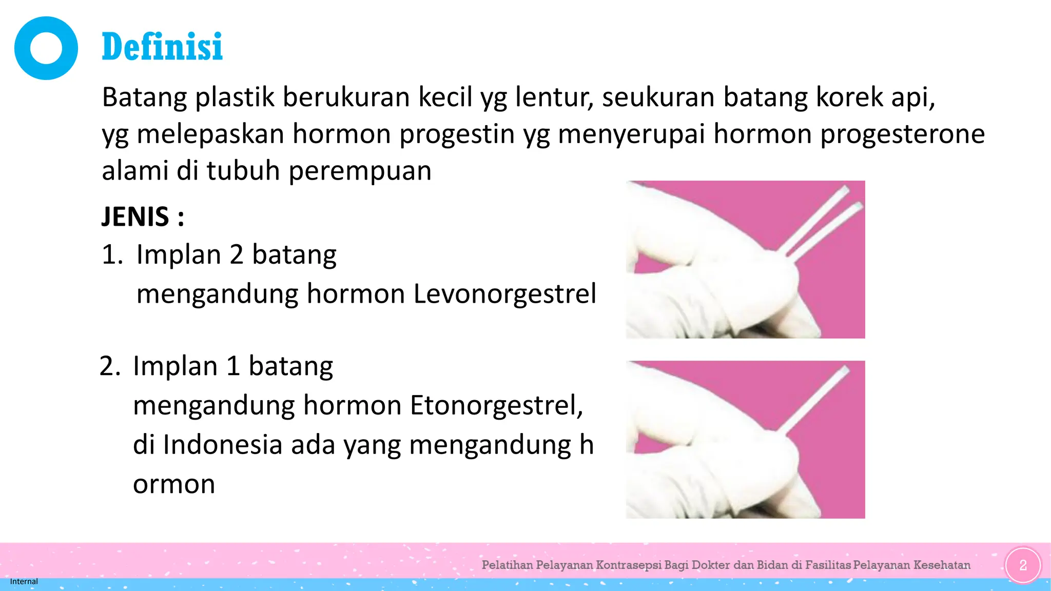 Implan di Indonesia - pemasangan efek samping komplikasi Mei 2024.pdf