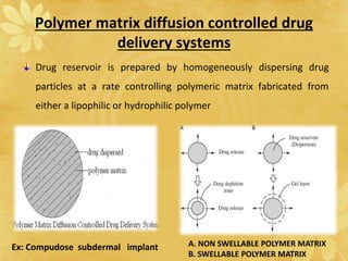 Implant : Challenging Drug Delivery System | PPTX
