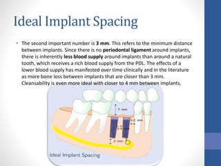 Implant | PPTX