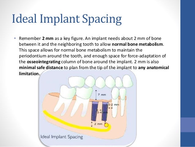 Implant