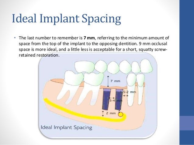 Implant