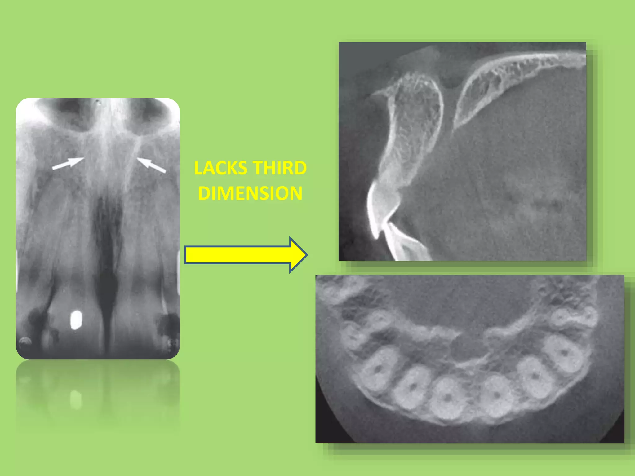 RADIOGRAPHIC IMAGING FOR DENTAL IMPLANT ASSESSMENT | PPTX