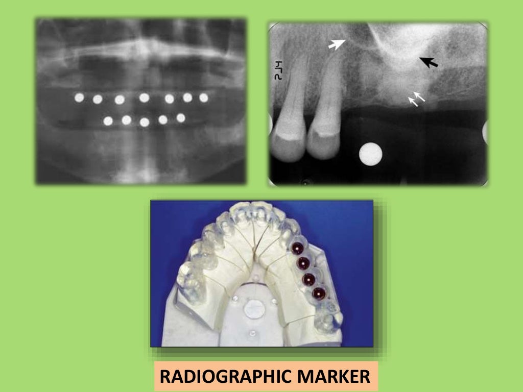 RADIOGRAPHIC IMAGING FOR DENTAL IMPLANT ASSESSMENT