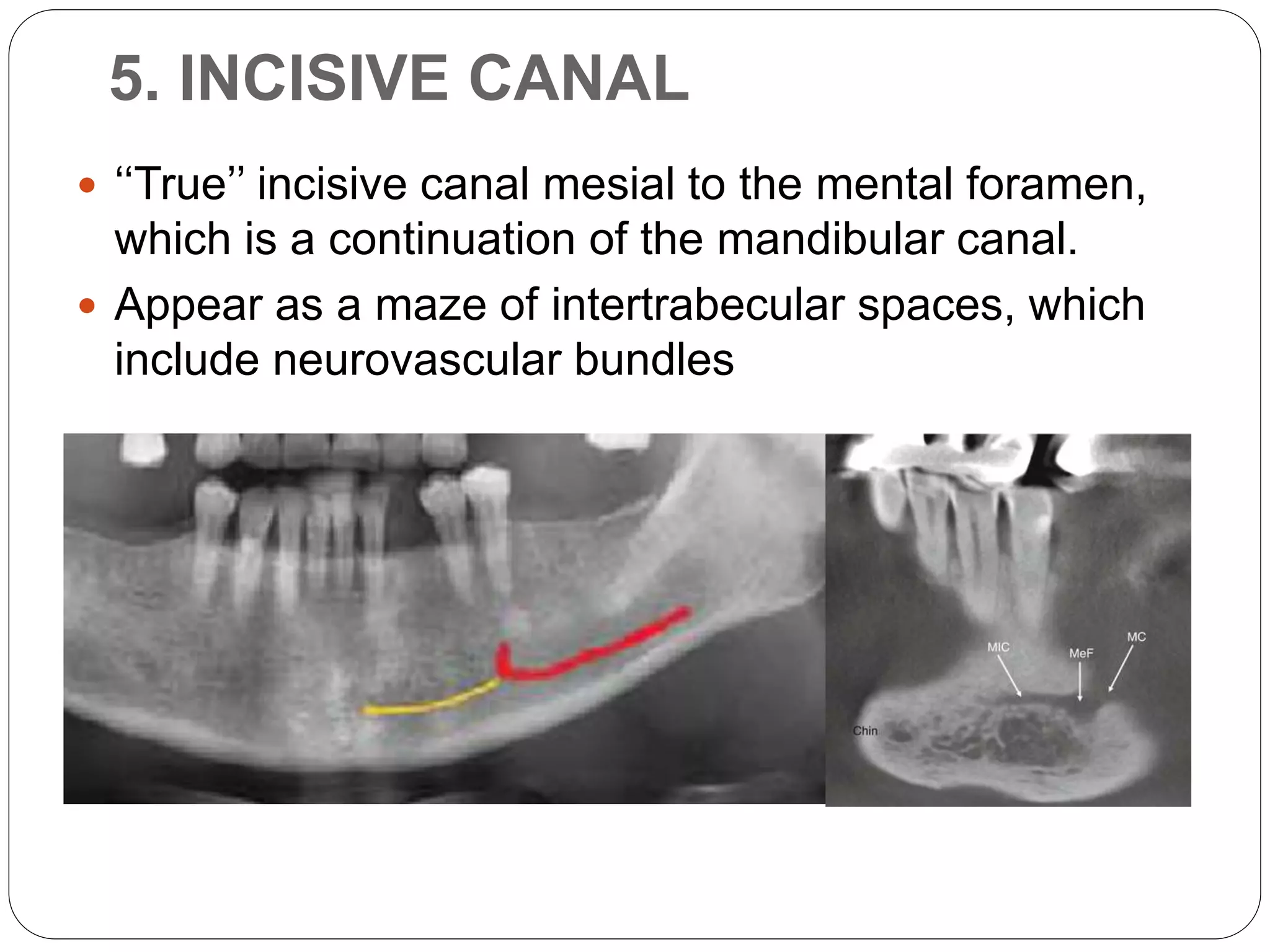 applied anatomy for denta Implant | PPTX