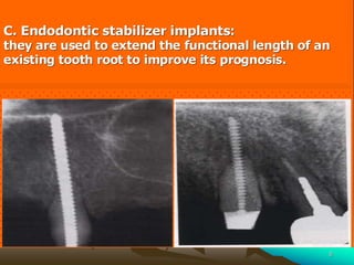 periodontology and dental implantology . | PPT