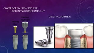 implantindentistryand .pptx