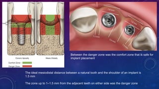 implantindentistryand .pptx