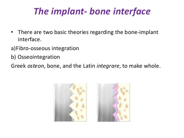 Implant seminar
