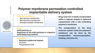 Implantable-Drug-Delivery-Systems-Lecture.pdf