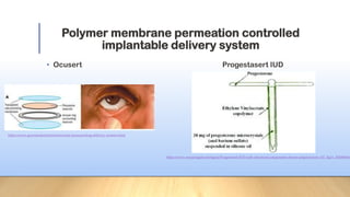 Implantable-Drug-Delivery-Systems-Lecture.pdf