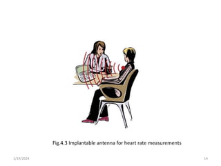 Implantable Antennas for Biomedical Applications | PDF