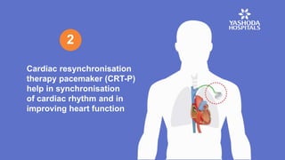 Pacemaker | Implantable Cardiac Devices For Heart Failures | PPT