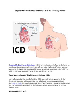 Implantable Cardioverter Defibrillator _theheart.pdf