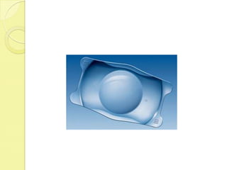 Implantable collamer lens(ICL) | PPTX
