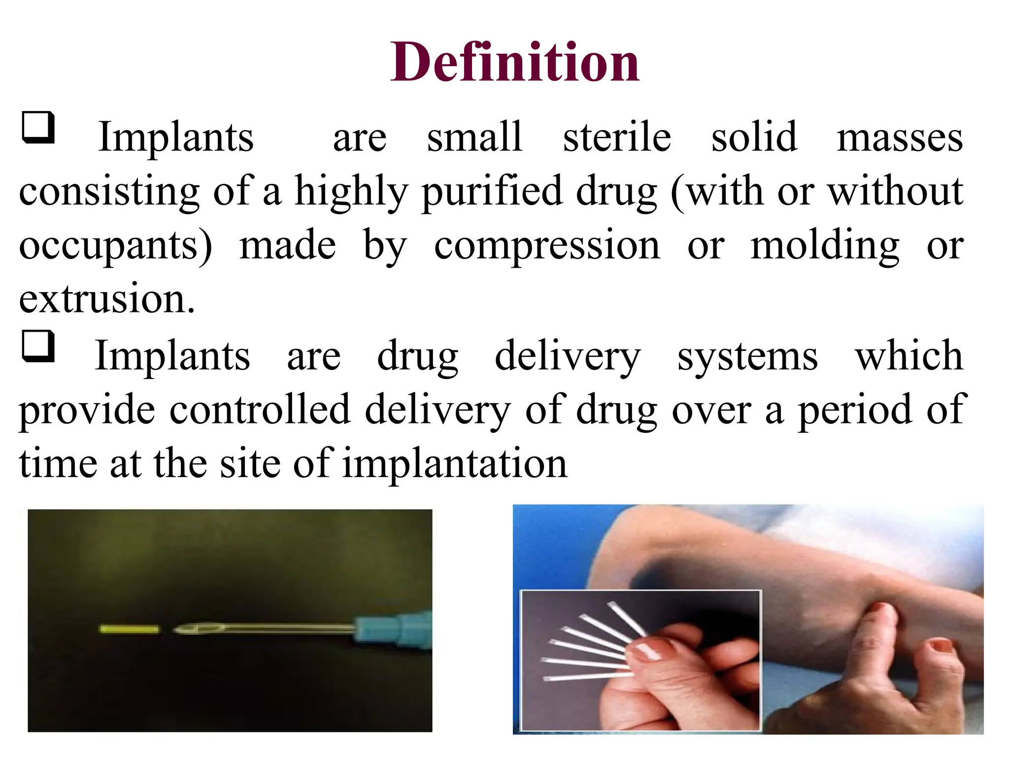 Implantable Devices for Drug Delivery.pptx