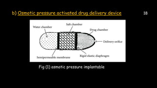 Implantable drug delivery system.pptx