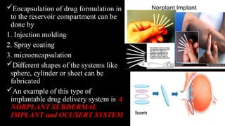 Implantable Drug Delivery System (IDDS).pptx