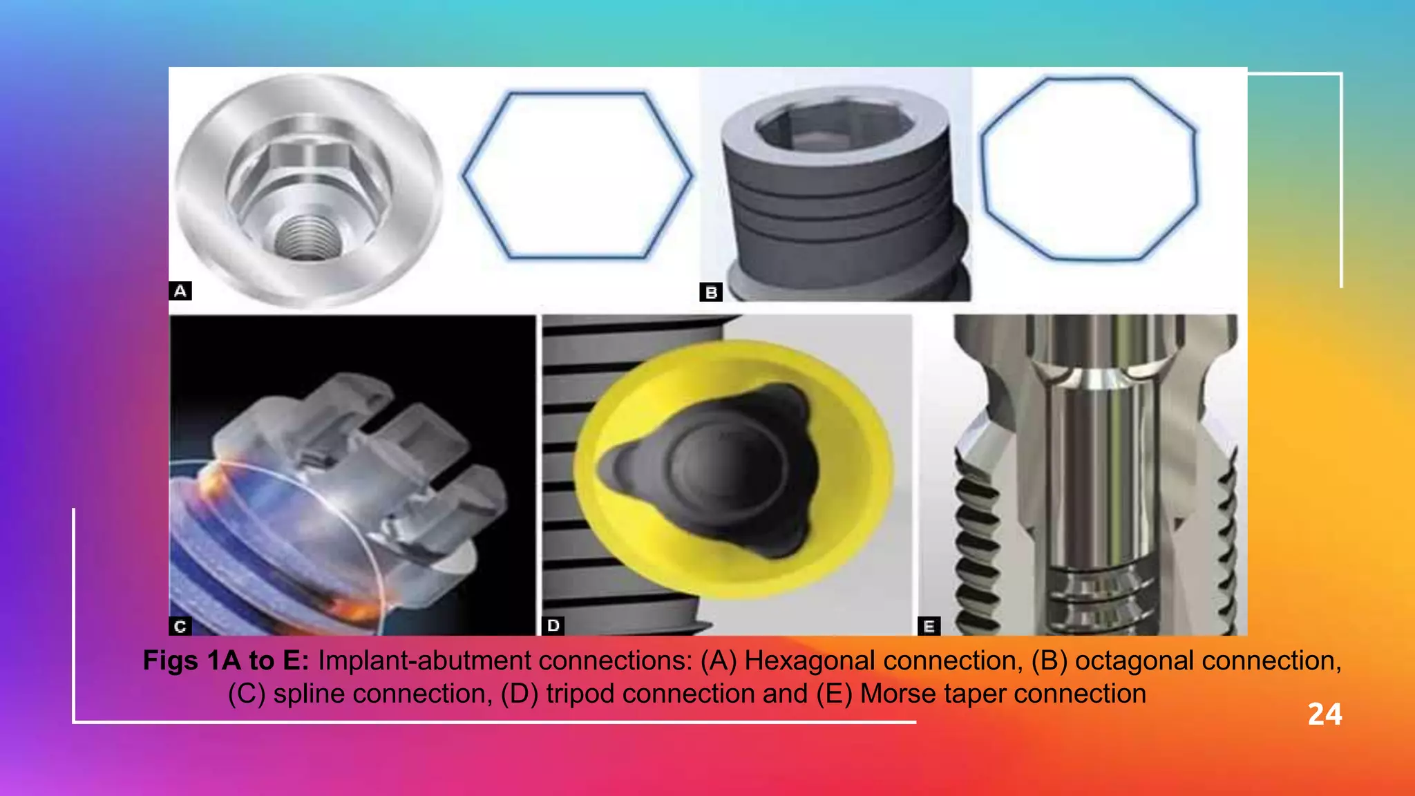 Implant abutment and implant abutment connections | PPTX