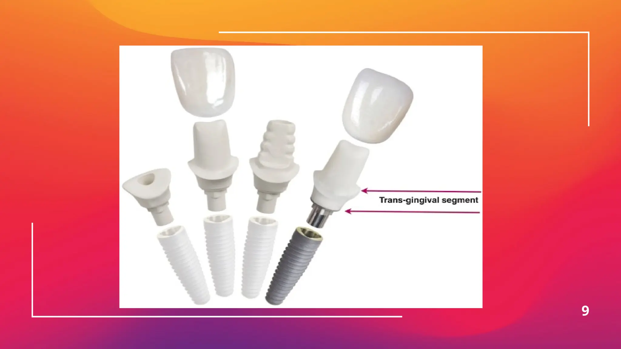 implant abutment and implant abutment connections.pptx