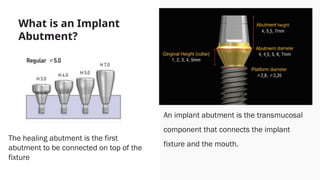 implant abutment selection criteria.pptx