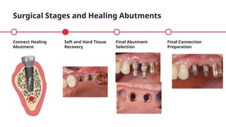 implant abutment selection criteria.pptx
