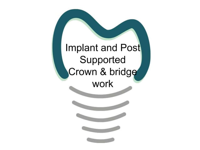 Implant and post supported crown and bridge presentation | PPTX