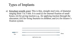Implant used in orthopedic surgery- physiotherapy | PPTX