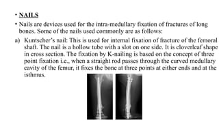Implant used in orthopedic surgery- physiotherapy | PPTX