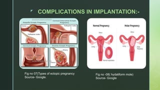 IMPLANTATION....pptx Fertilization & Implantation | PPT