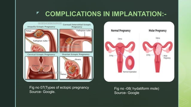 IMPLANTATION....pptx Fertilization & Implantation | PPT