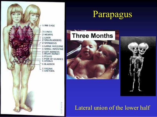 Implantation of embryo 3