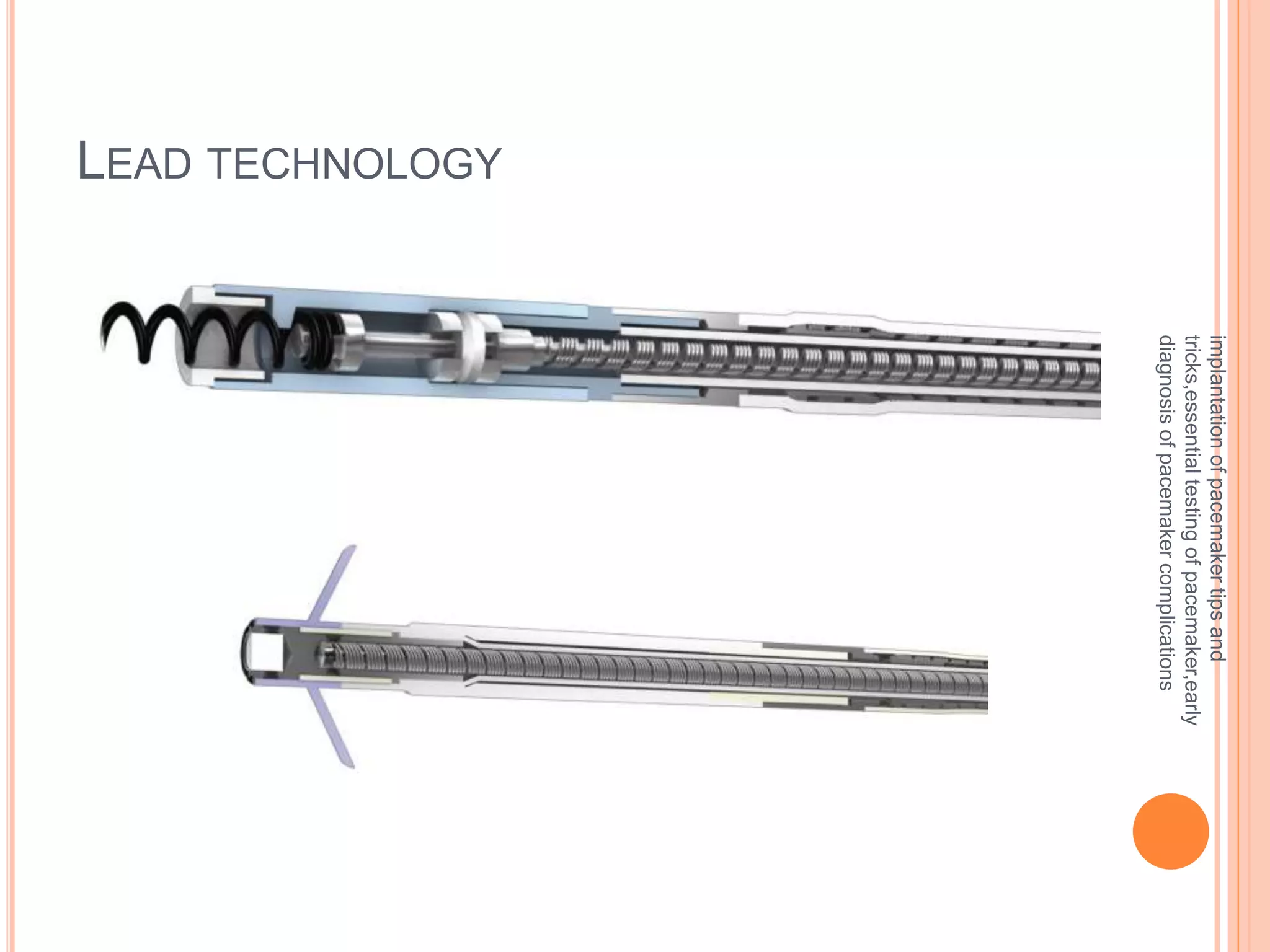 fundamentals of pacemaker | PPTX