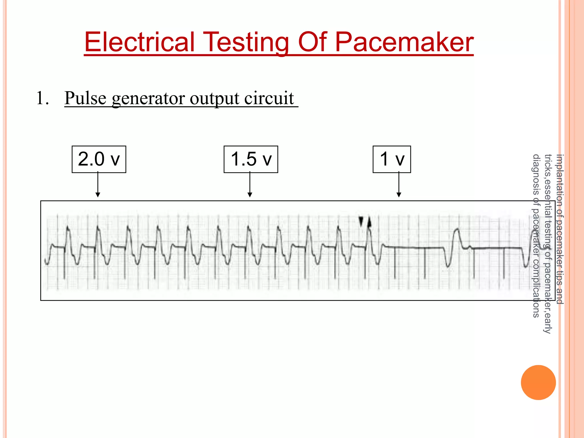 fundamentals of pacemaker | PPTX
