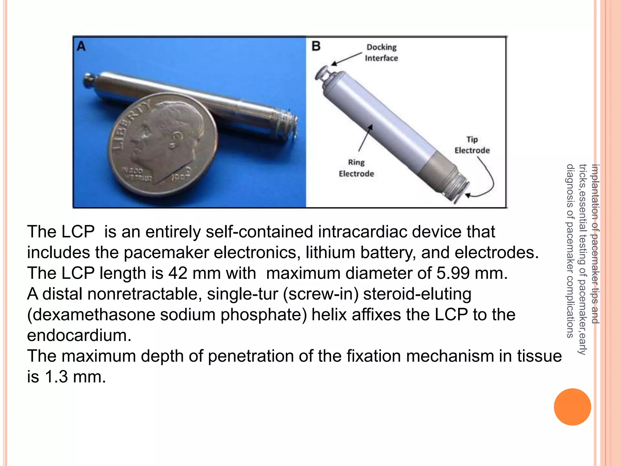fundamentals of pacemaker | PPTX