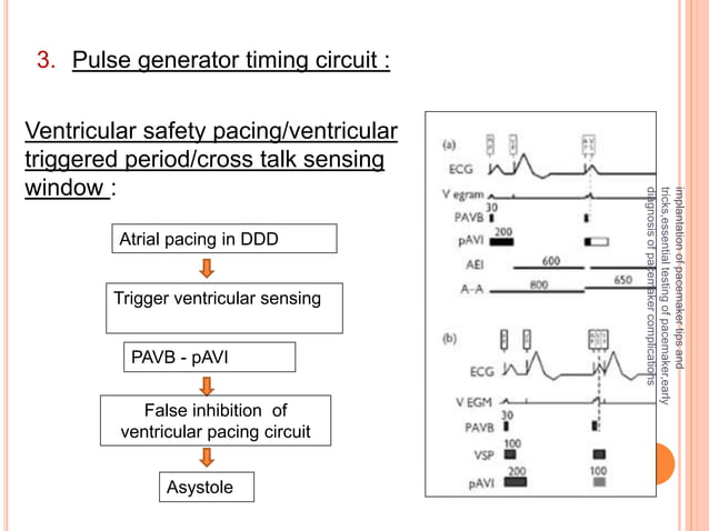 fundamentals of pacemaker | PPTX | Heart and Cardiovascular Diseases ...