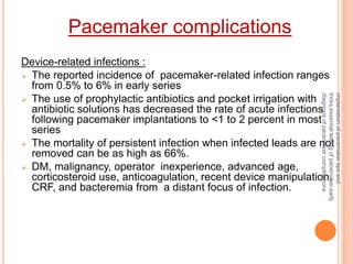 fundamentals of pacemaker | PPT