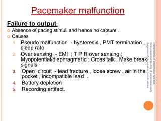 fundamentals of pacemaker | PPT
