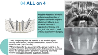 Implantation Options.pptx | Dental Health | Diseases and Conditions
